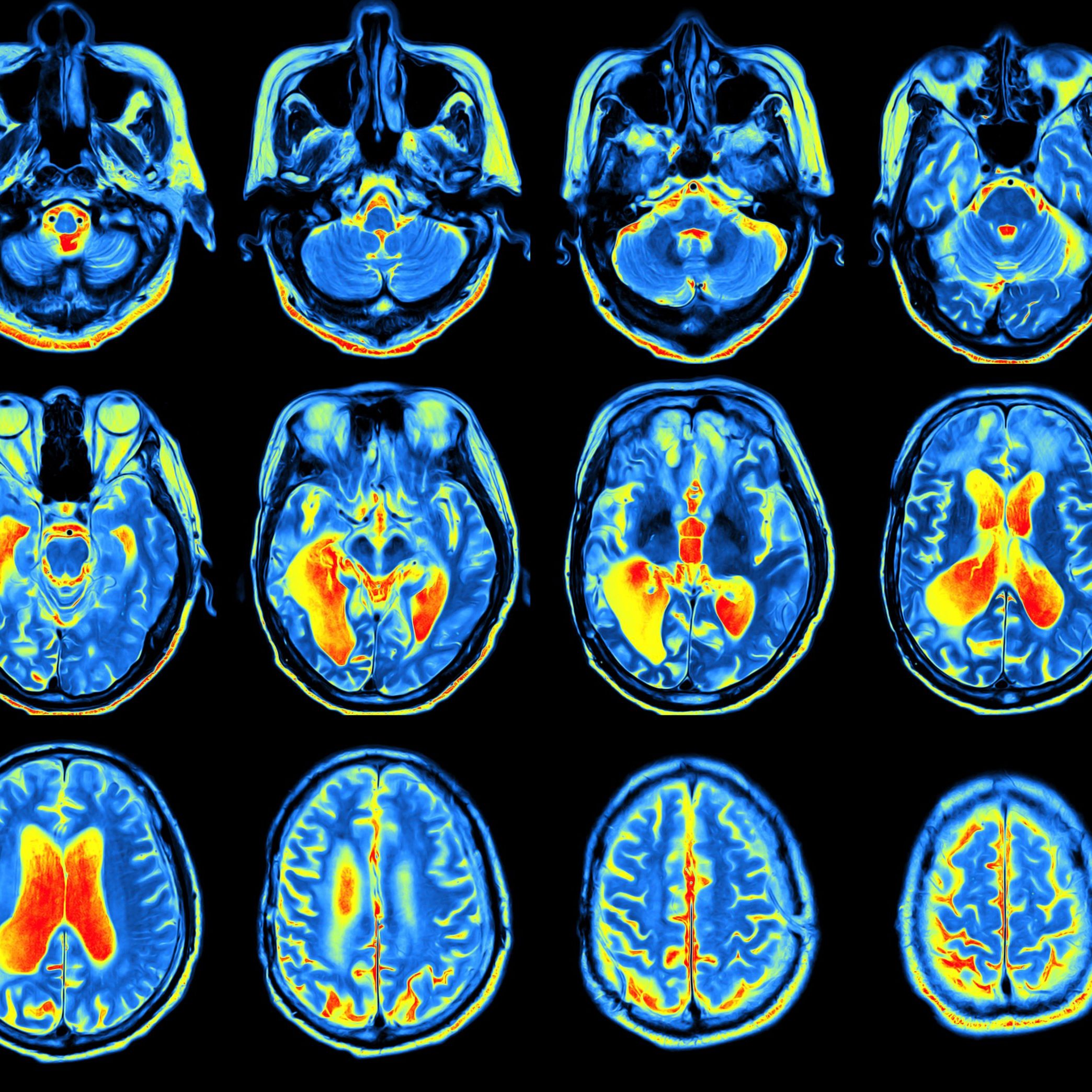 Beyond the Brain | Inspiring Impact